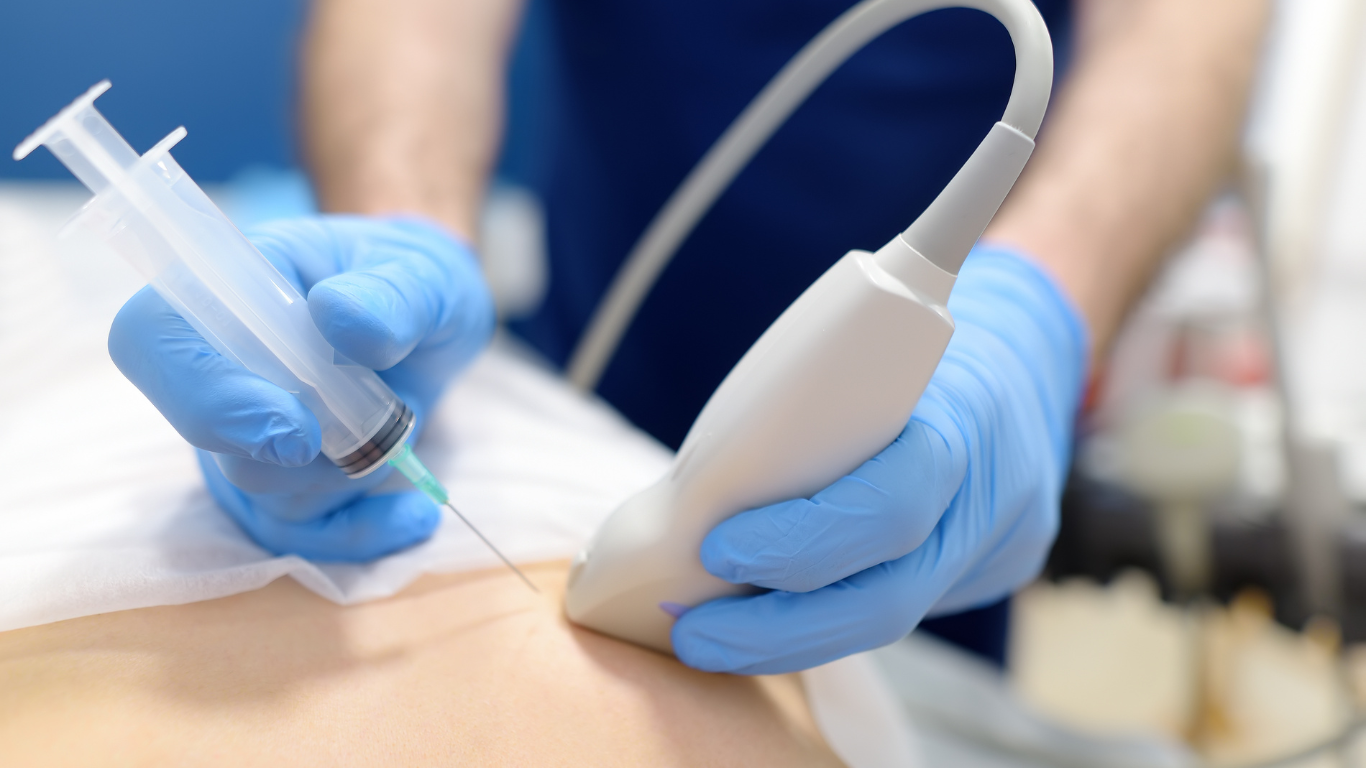charles procedure lymphedema | lymphedasia